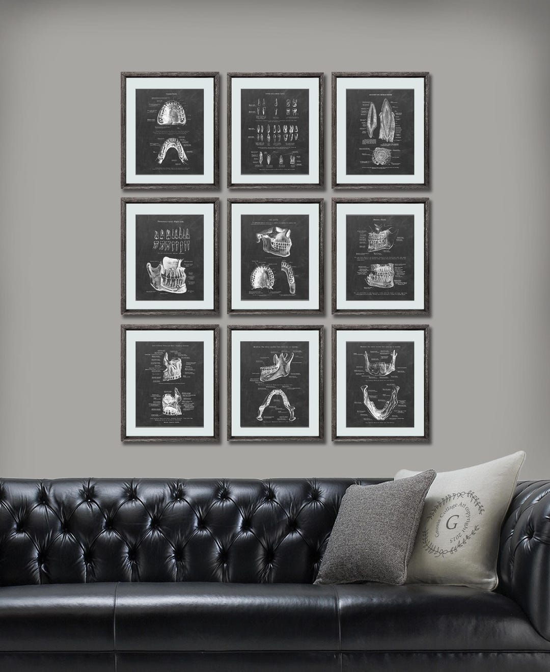 Dental Office Decor Teeth Anatomy, Chalkboard Style, Set of 9 Unframed ...