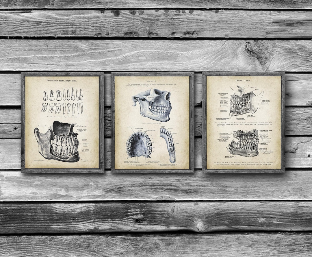 Vintage Teeth Anatomy Art Prints – Set of 3, Dental Decor - Etsy