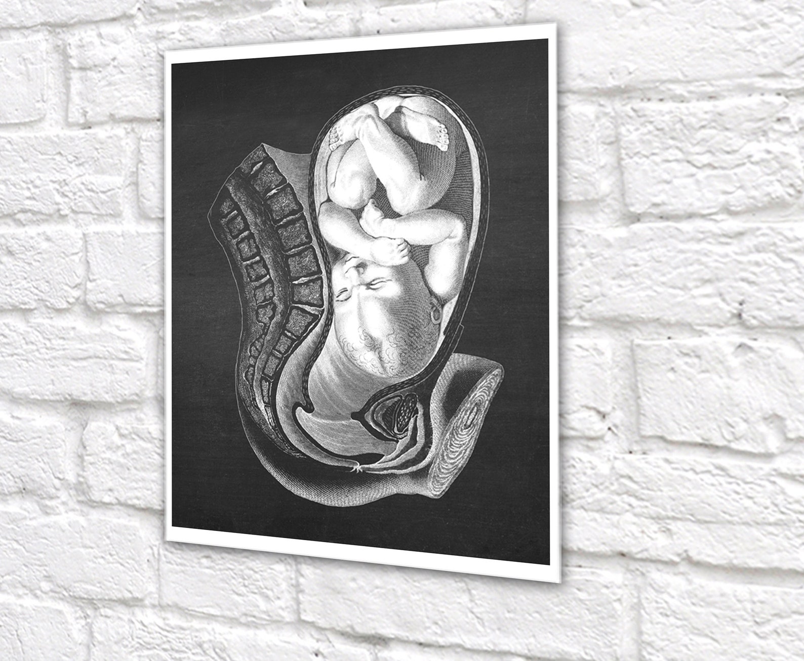 Pregnancy Womb Anatomy Art Set of 3 Unframed Decor Art Prints - Etsy
