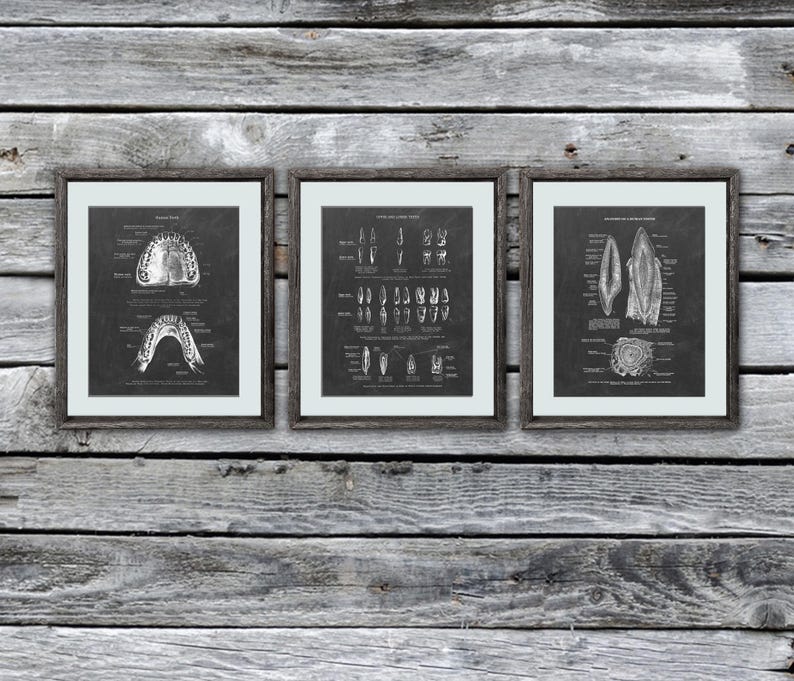 Dental Office Decor Teeth Anatomy, Chalkboard Style, Set of 9 Unframed ...