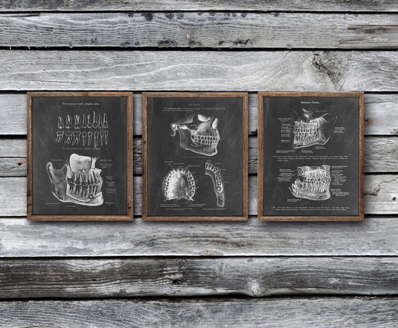 Anatomy of Teeth Prints Set – Chalkboard Dental Office Art - Etsy