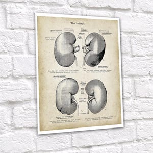Kidney Anatomy Art Prints (set of 3) – Vintage Medical Decor - Etsy