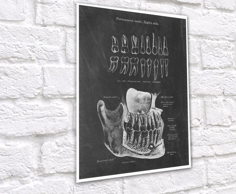 Anatomy of Teeth Prints Set – Chalkboard Dental Office Art - Etsy