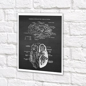 Neuroscience Anatomy of Human Brain Set of 3 Unframed Decor Art Prints ...