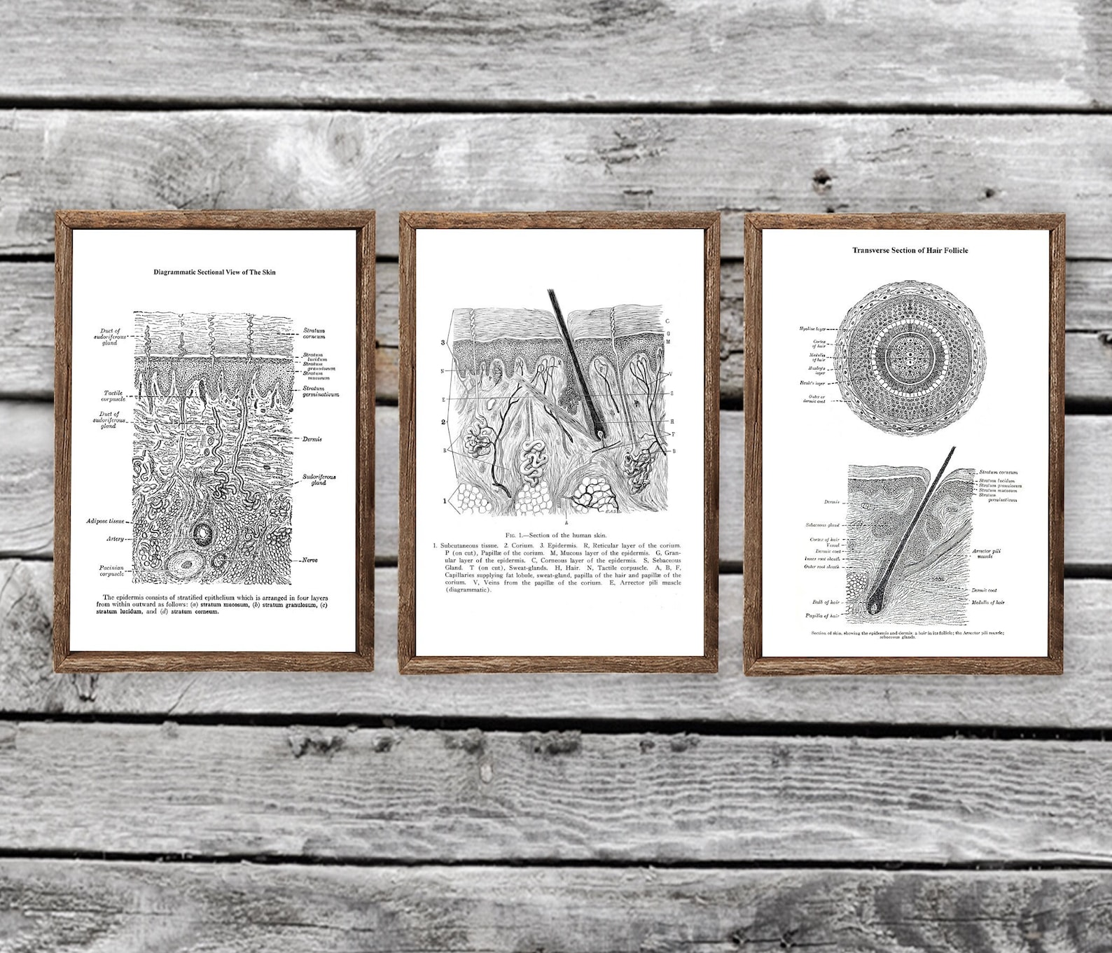 Dermatologist Art Set of 3 Unframed Skin Epidermis Anatomy Wall Decor ...