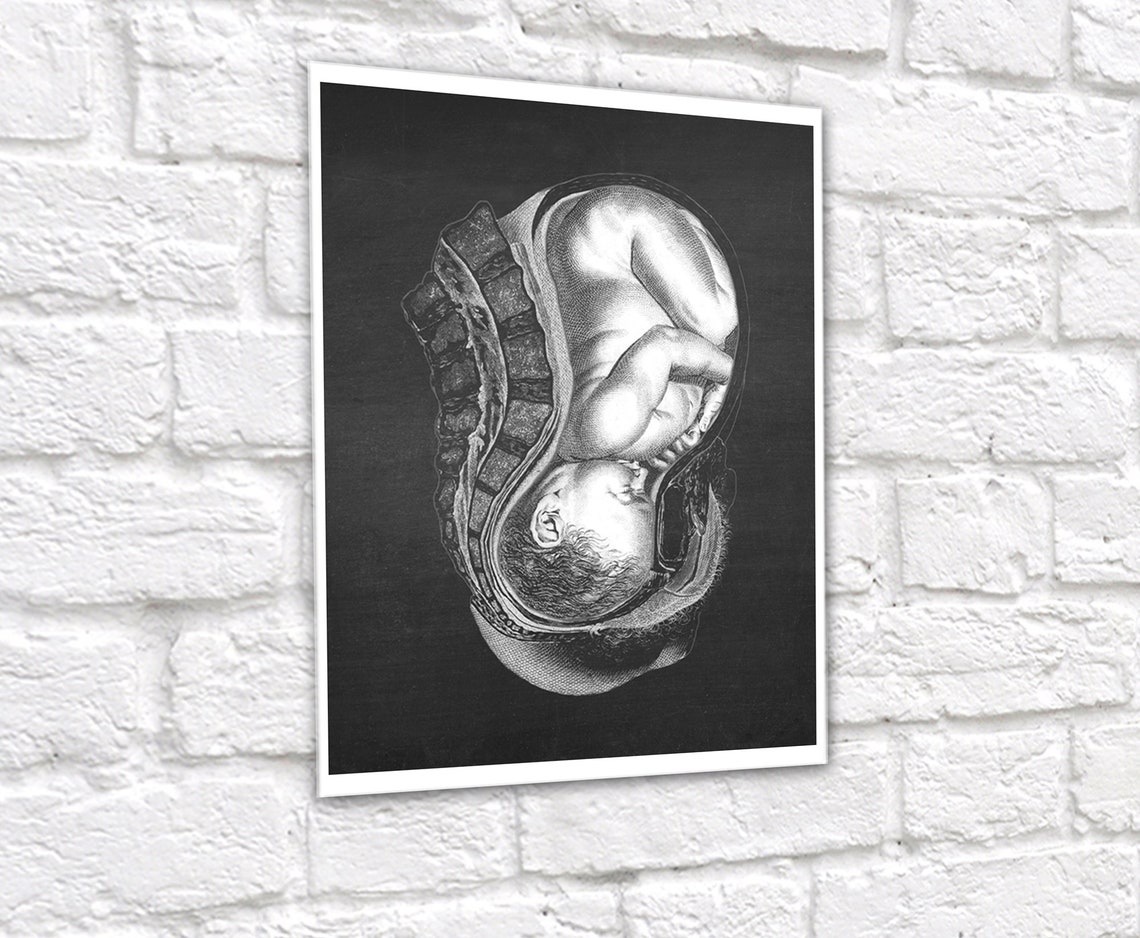 Pregnancy Womb Anatomy Art Set of 3 Unframed Decor Art Prints | Etsy