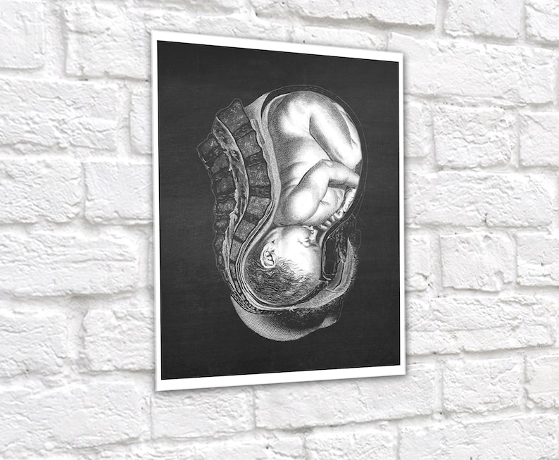 Pregnancy Womb Anatomy Art Set of 3 Unframed Decor Art Prints - Etsy
