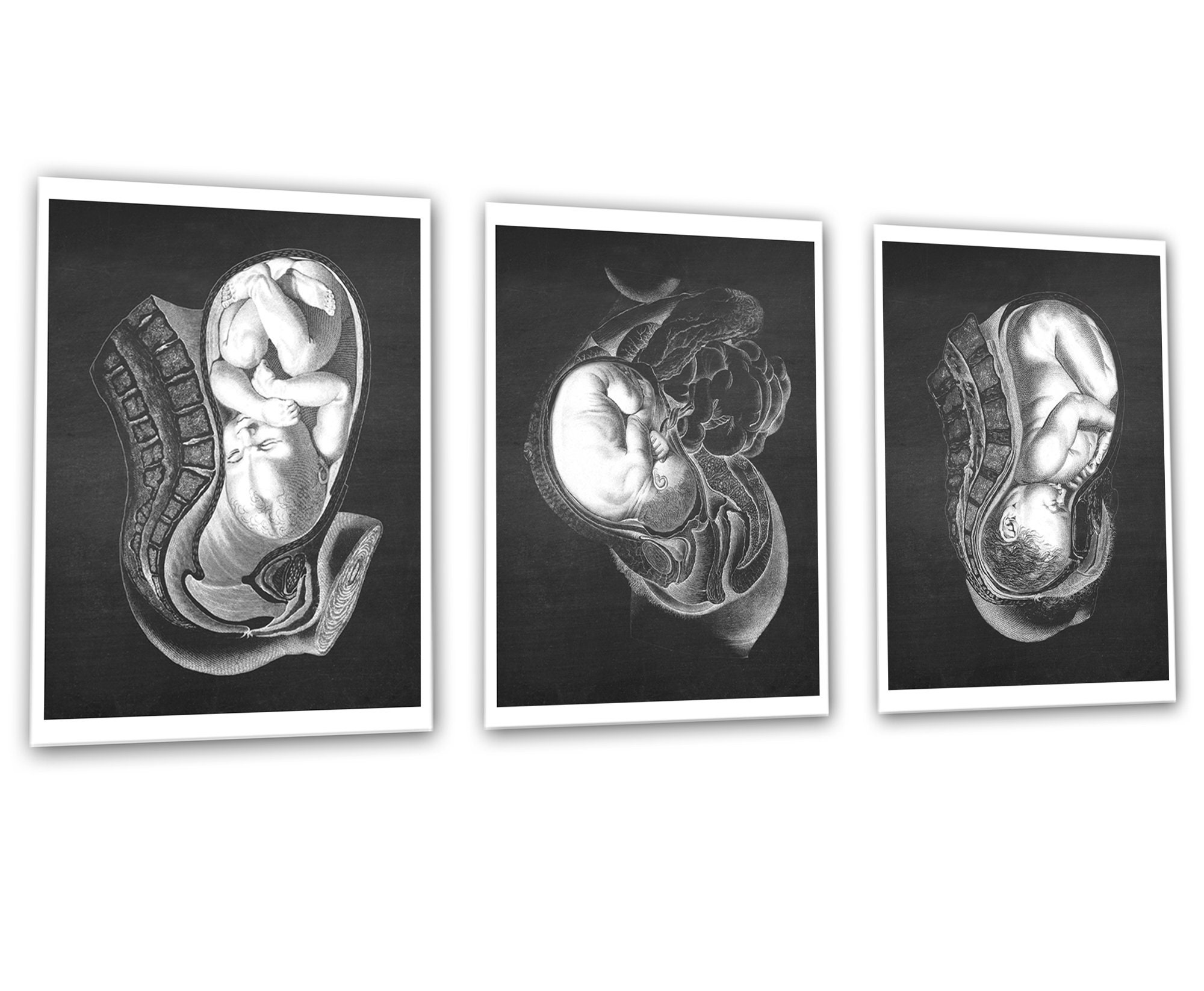 Womb Anatomy Art Prints, Set of 3, Obstetrics and Gynecology Decor - Etsy