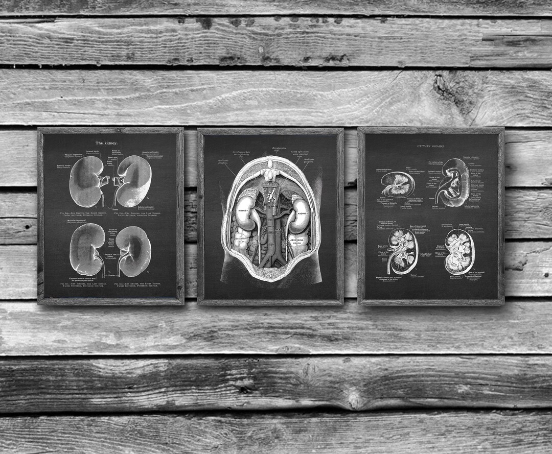 Kidney Anatomy Art Set of 3 Unframed Prints - Nephrology Urology ...