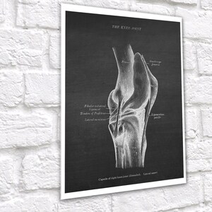 Knee Joint Anatomy Art Prints Set of 3 Unframed Orthopedic / Physical ...