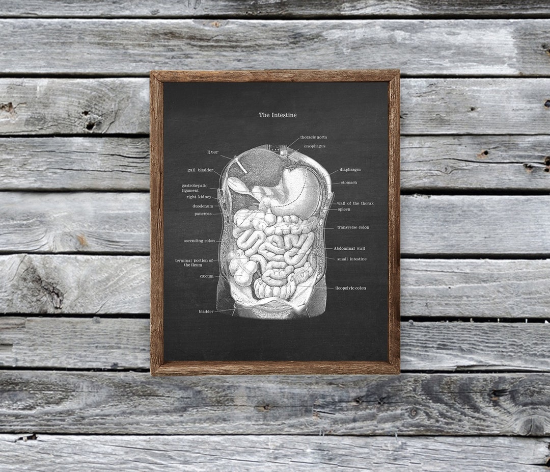 Anatomy of Intestine Medical Classroom Clinic Doctor Office Wall Decor ...