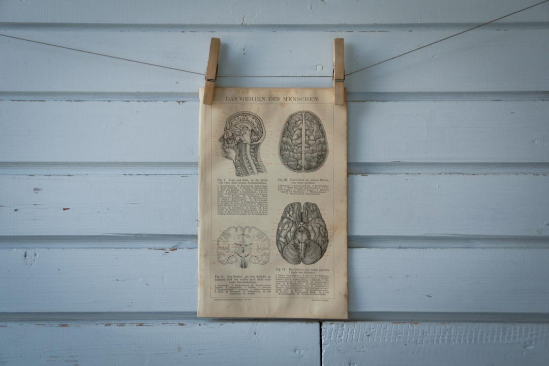 1887 Vintage Brain Anatomy Lithograph Illustration - Etsy