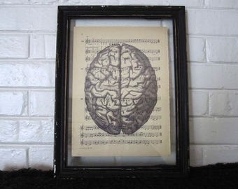 Armless Skeleton Woman Art Print on Vintage Music Sheet Human Anatomy ...