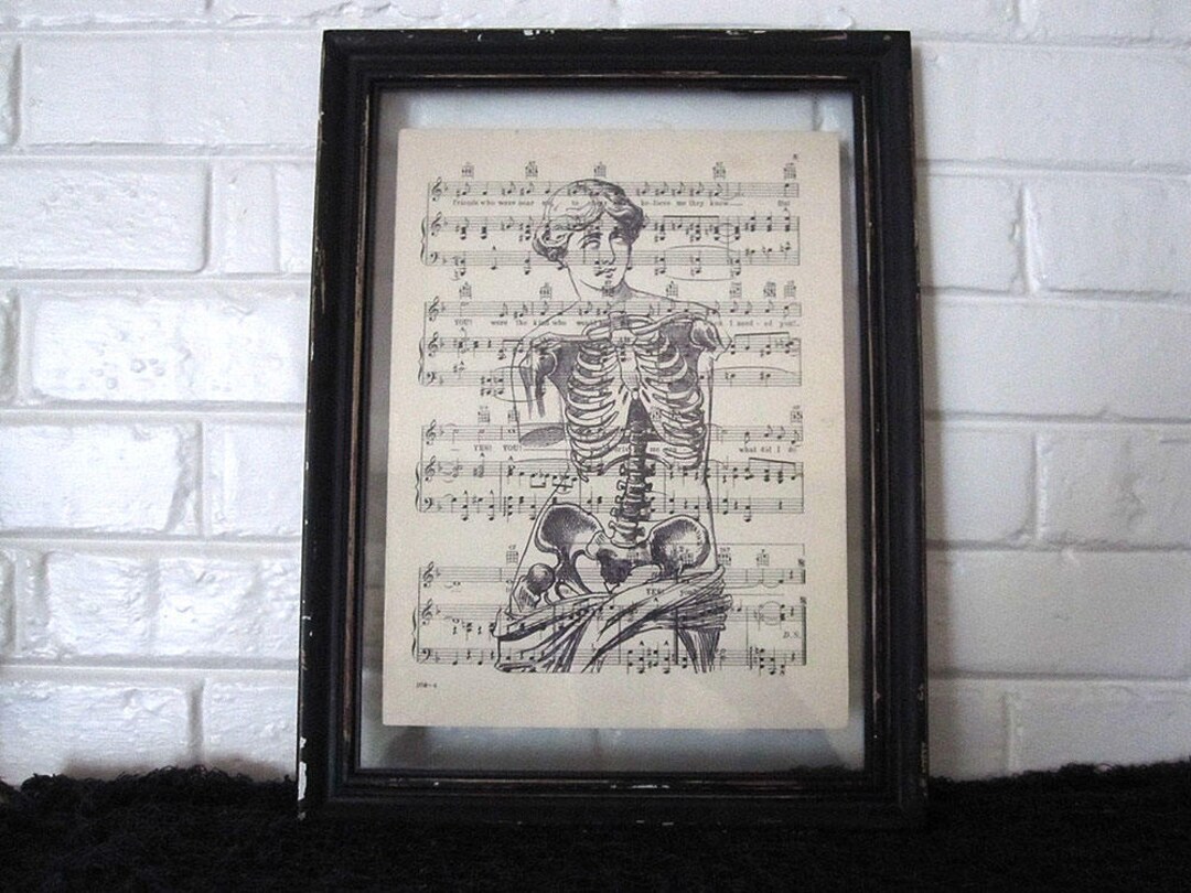 Armless Skeleton Woman Art Print on Vintage Music Sheet - Human Anatomy ...