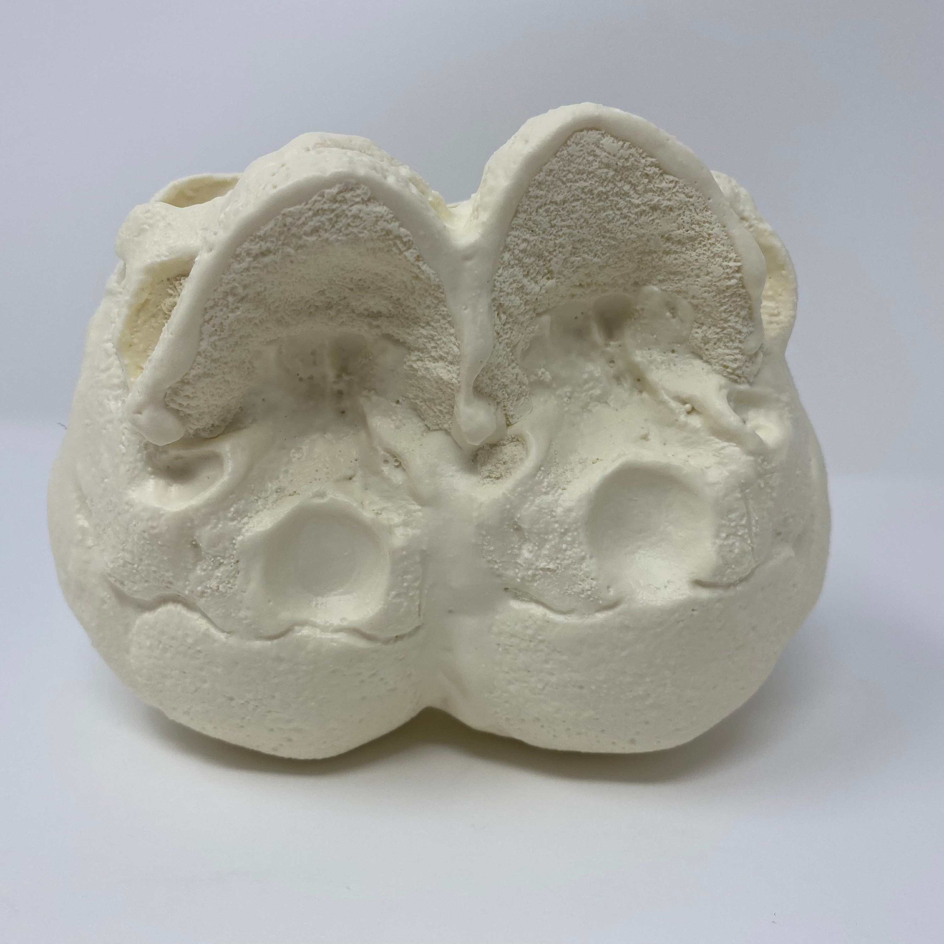 Conjoined Twins Fetal Skull Replica - Etsy UK