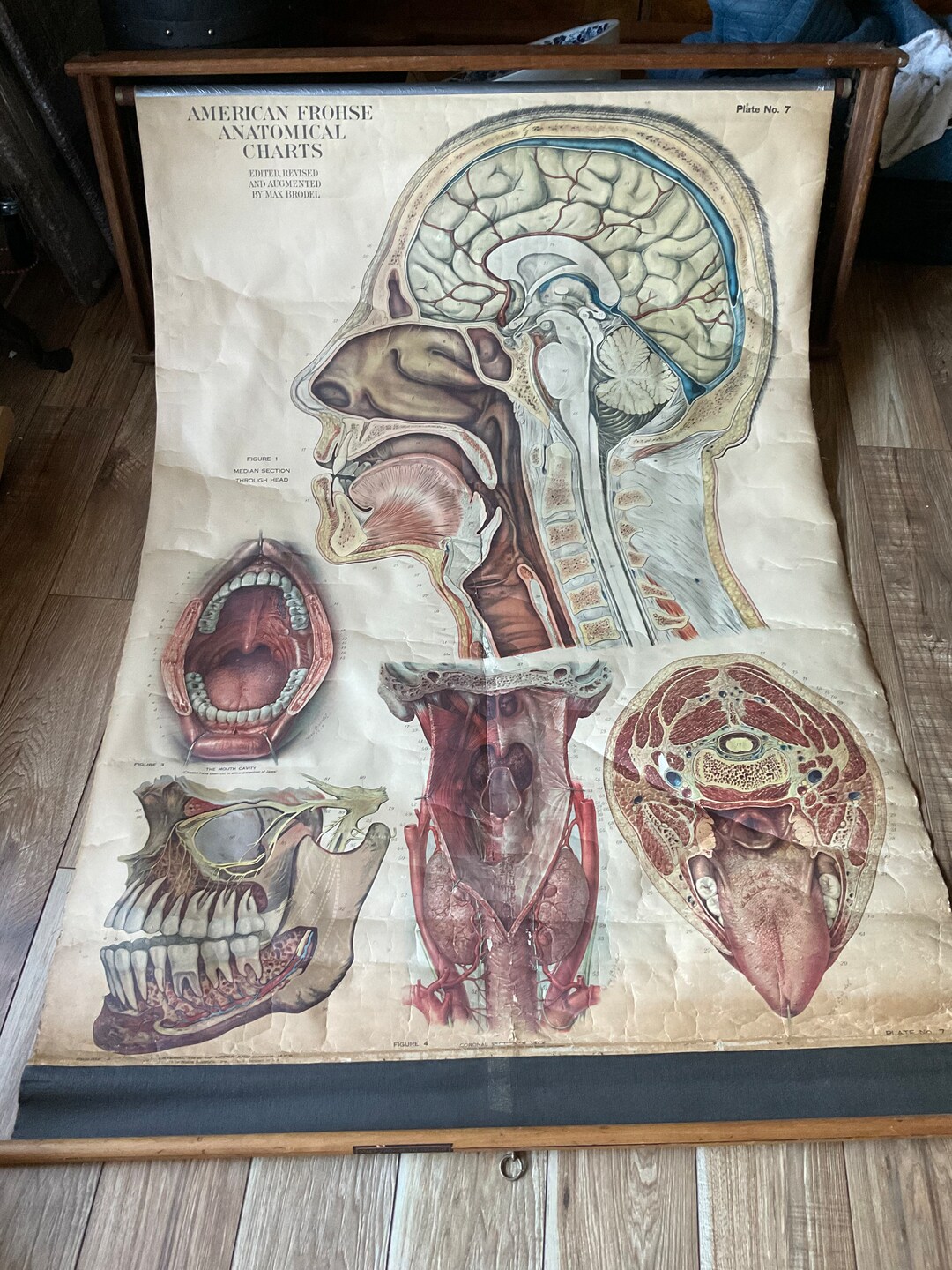 Antique Anatomy Chart American Frohse/max Brodel Signed & Mounted - Etsy