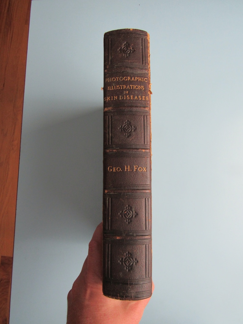 Photographic Illustrations of Skin Diseases by George Henry Fox 1887 ...