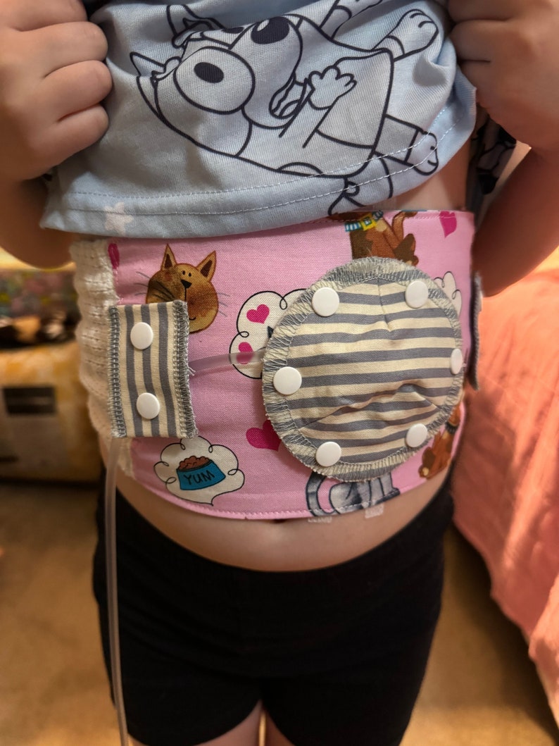 FREE 10 Pads, G-tube, J-tube, Belly Belt, Mic-key Button, Protection ...