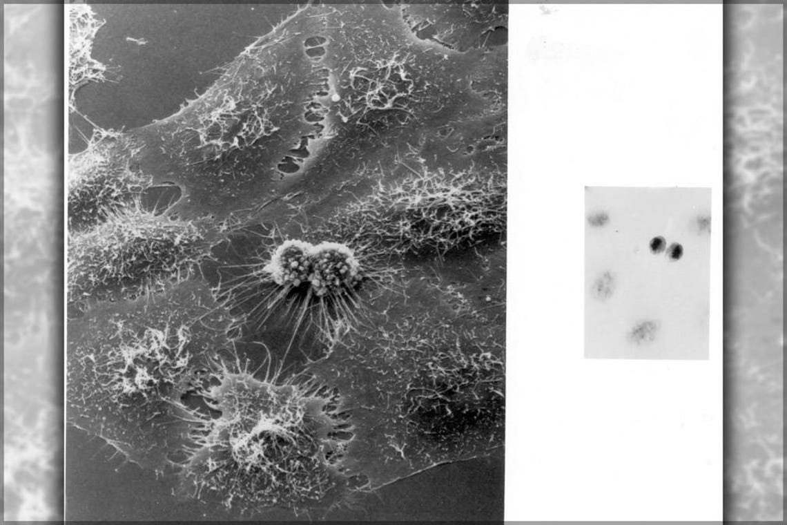 Poster, Many Sizes Available; Hela Cells Dividing Under Electron ...