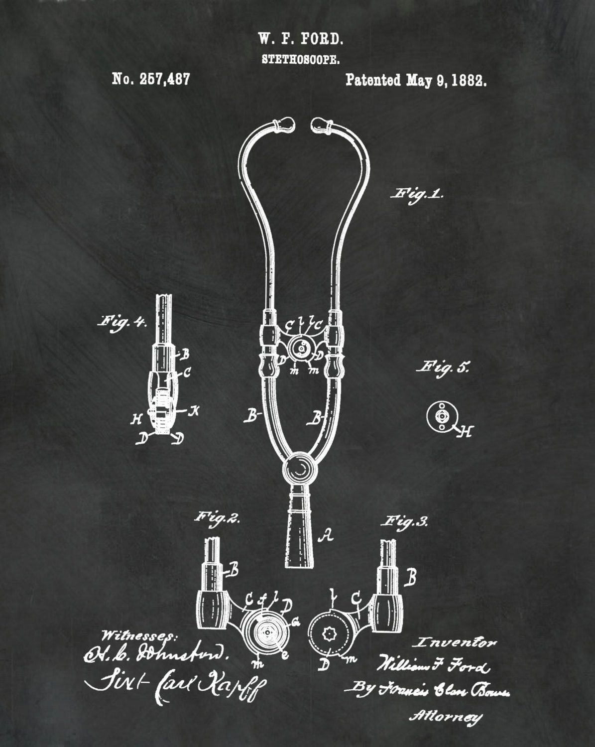 1882 Ford Stethoscope Patent Print - Doctor's Office Poster - Physician ...