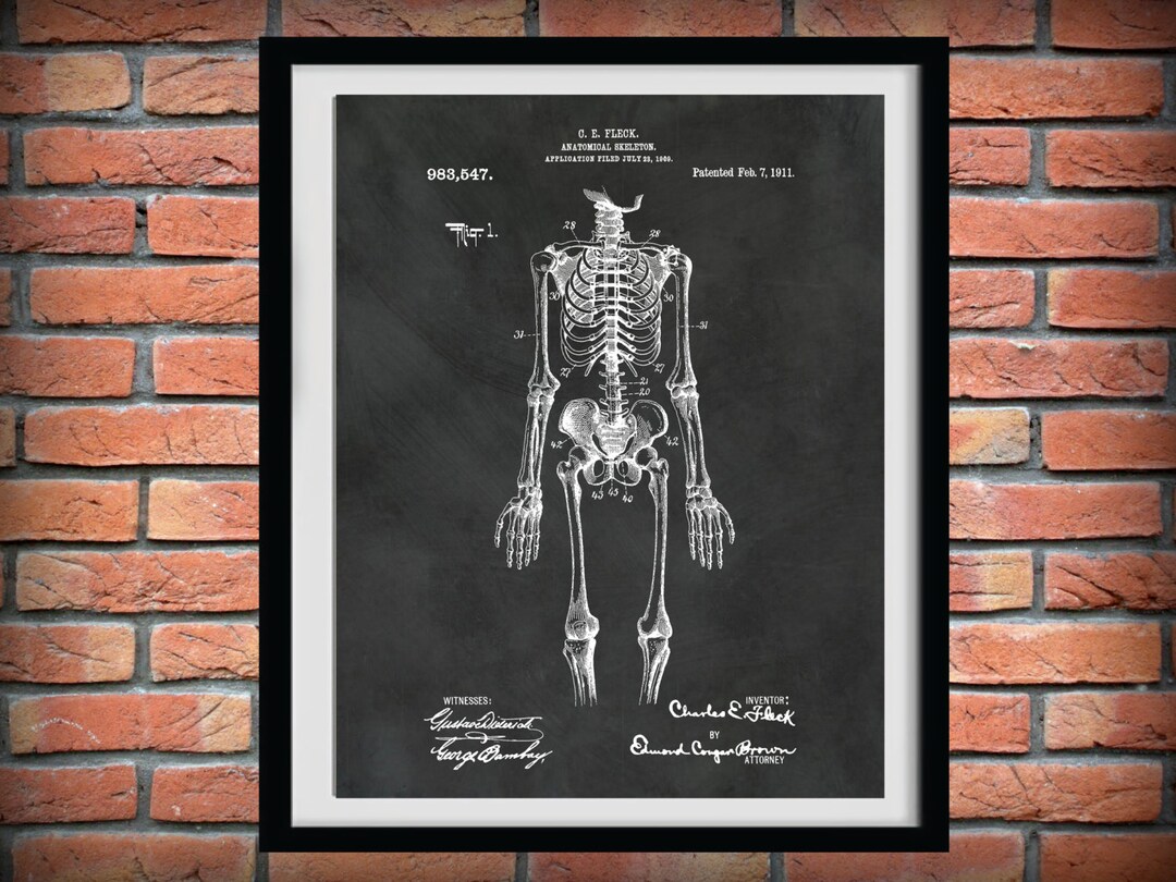 1911 Skeleton Patent Print, Anatomical Skeleton Poster, Orthopedic ...