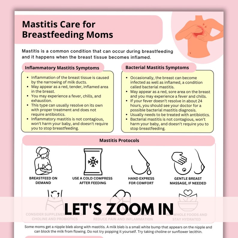 Breastfeeding Education Guide for Mastitis, New Mastitis Protocol PDF, Breastfeeding Graphics ...