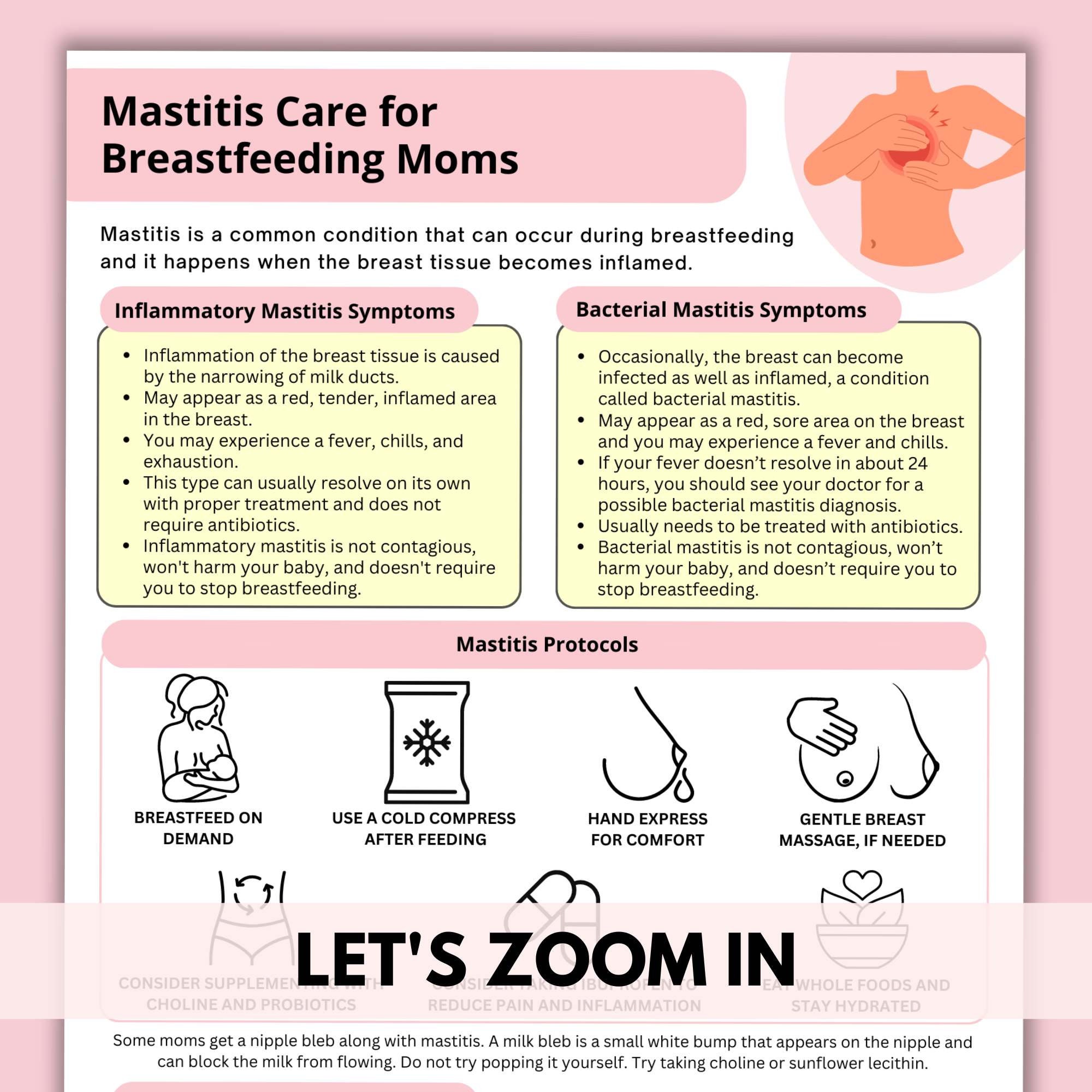 Breastfeeding Education Guide for Mastitis, New Mastitis Protocol PDF ...