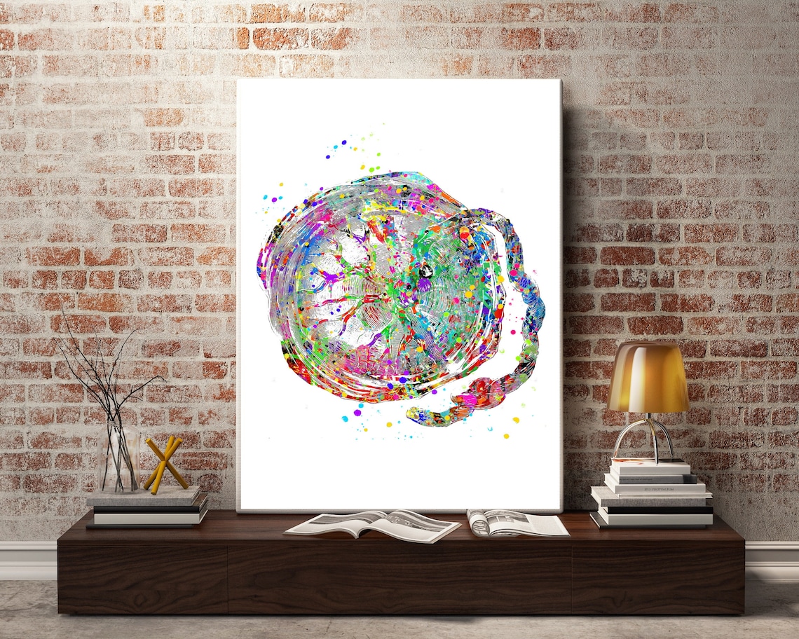 Placenta Print Womb Pregnancy Anatomy Gynecology Obstetrician - Etsy