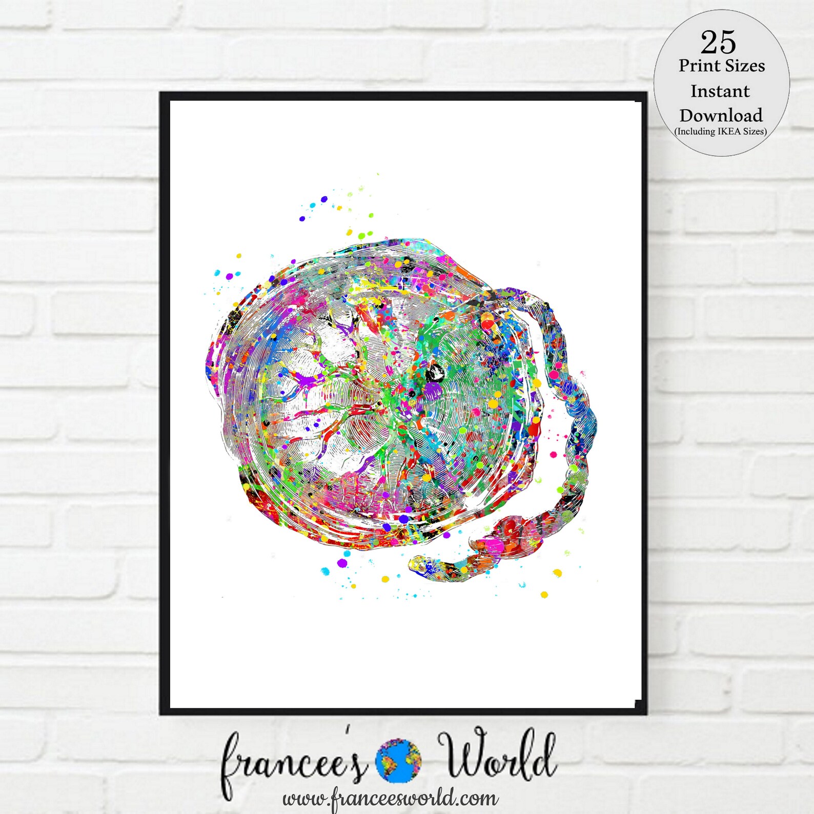 Placenta Print Womb Pregnancy Anatomy Gynecology Obstetrician - Etsy