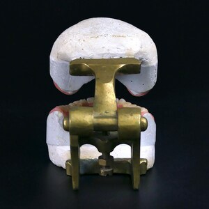 Articulated Denture From the 19th Century in Porcelain Plaster and ...