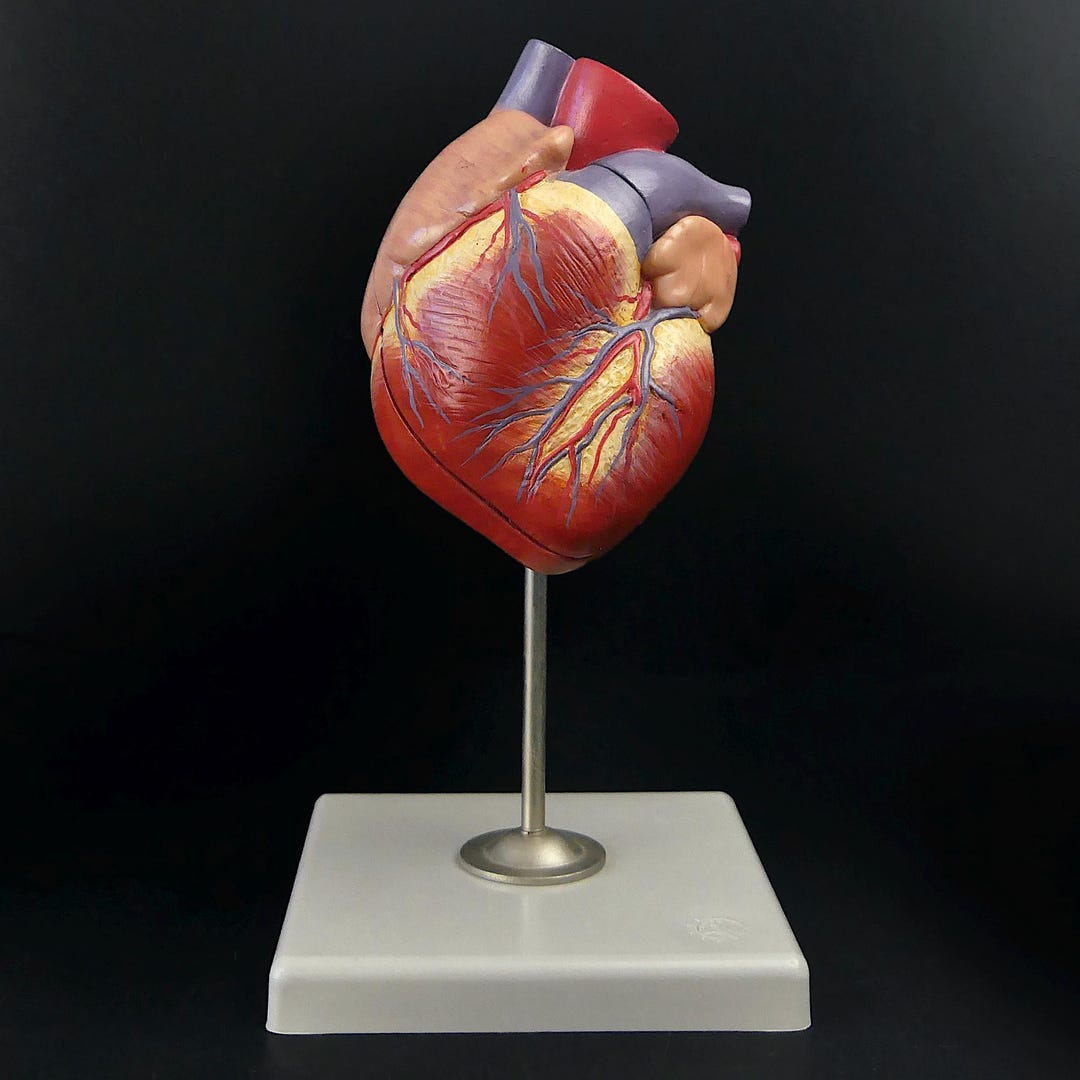 Vintage SOMSO Anatomical Heart Model: Mid-century Didactic Display - Etsy
