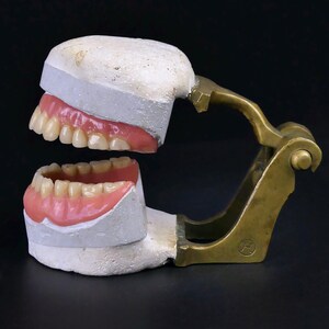 Articulated Denture From the 19th Century in Porcelain Plaster and ...