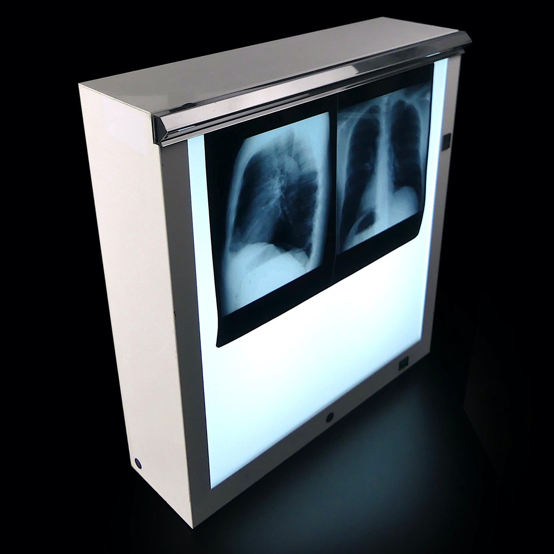 Vintage Negatoscope Illuminated Wall Board ELLA France Medical ...