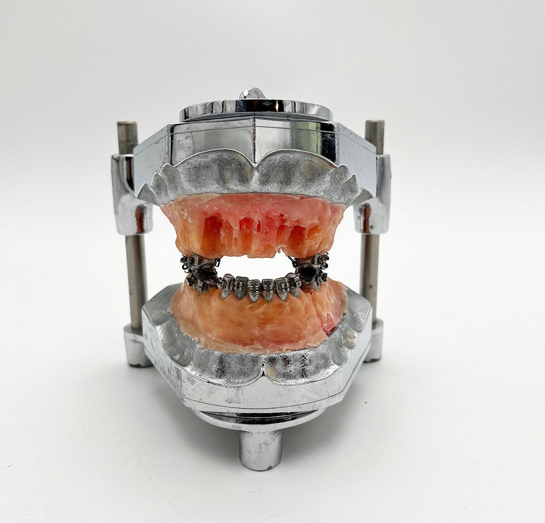 Antique Orthodontic Teeth Circa 1960s/70s - Etsy