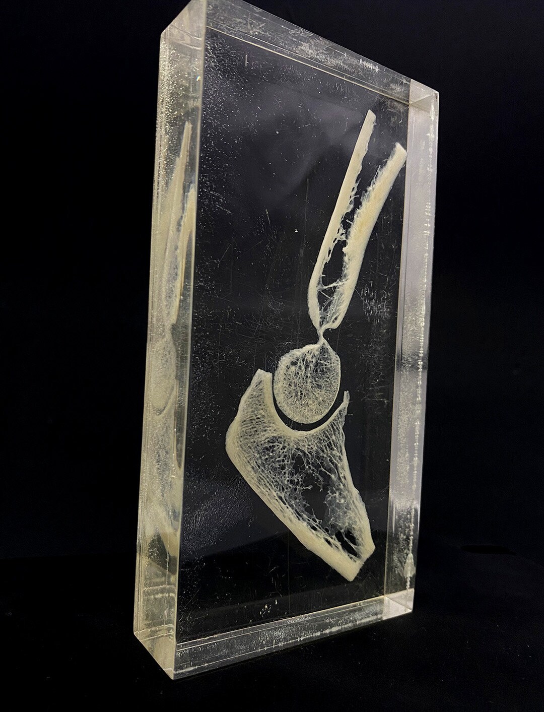 Cross Section Infant Child's Foot: Plastination - Etsy