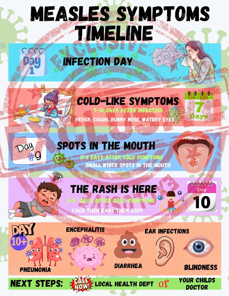 Measles Symptoms Timeline Printable |measles Infographic for Schools ...