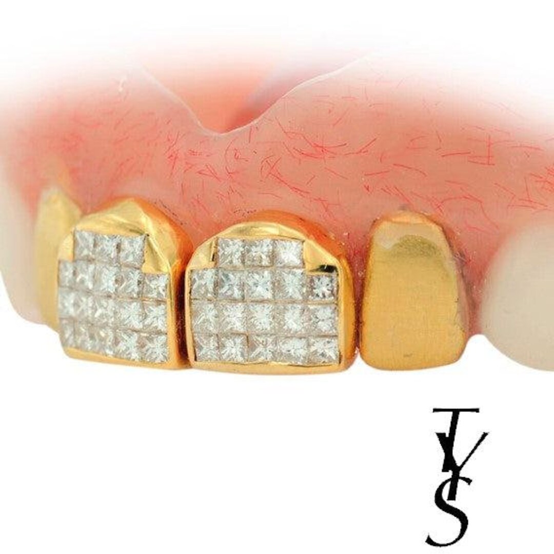 Four Individual Teeth Denture Grill - Etsy