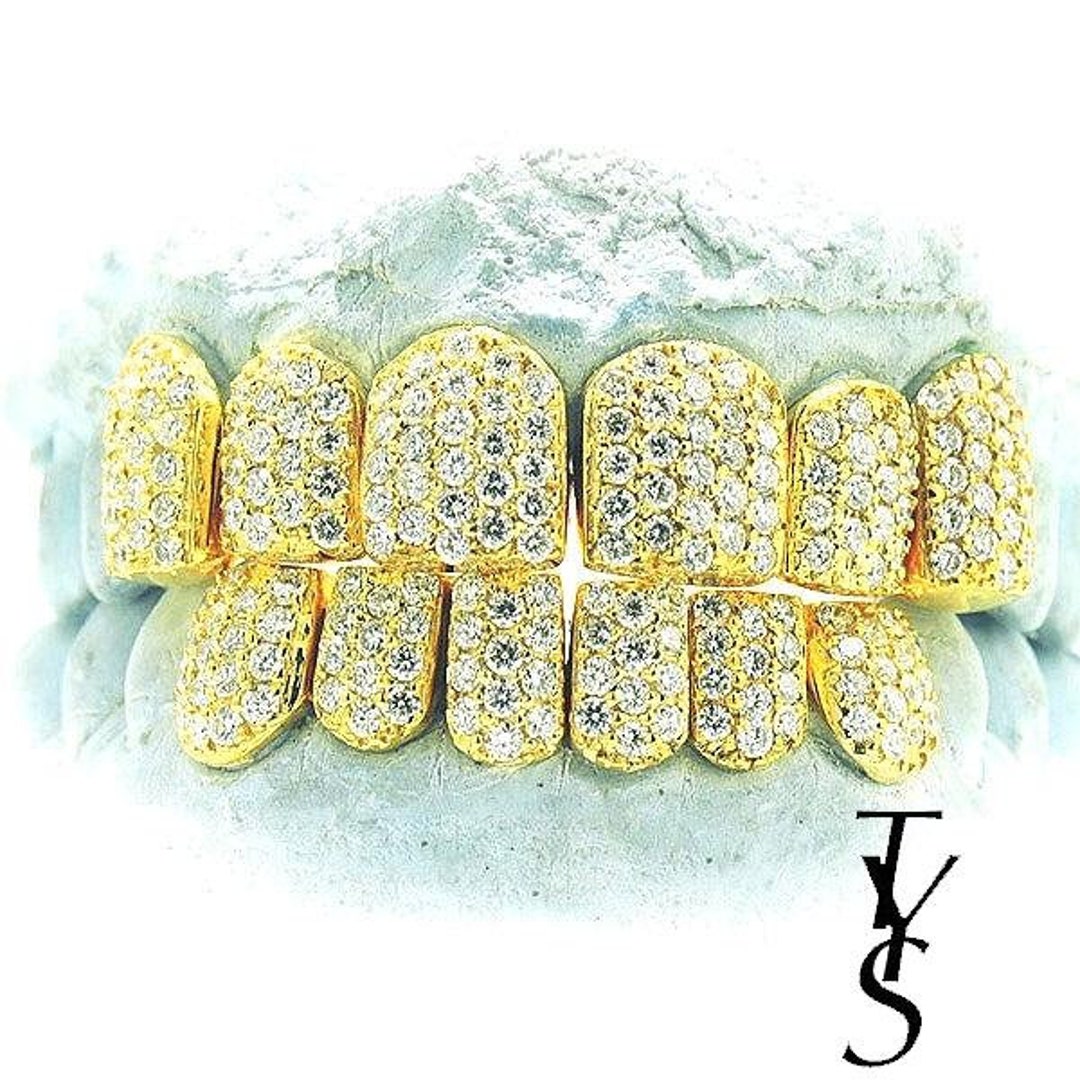 New 18k Individual Diamond Prong Set Permanent Teeth - Etsy