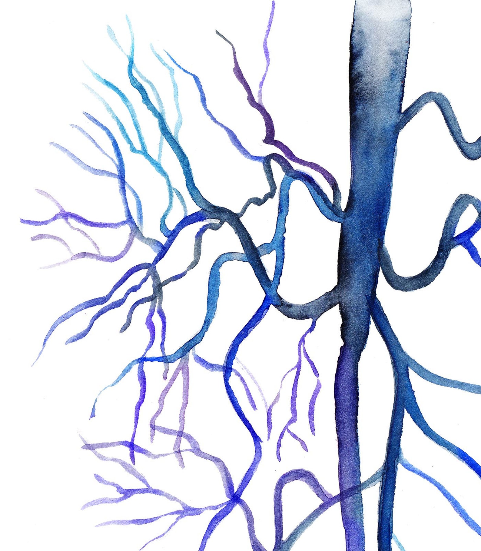 Aorta Angiogram Print, Medical Poster, Science Art, Abdominal ...