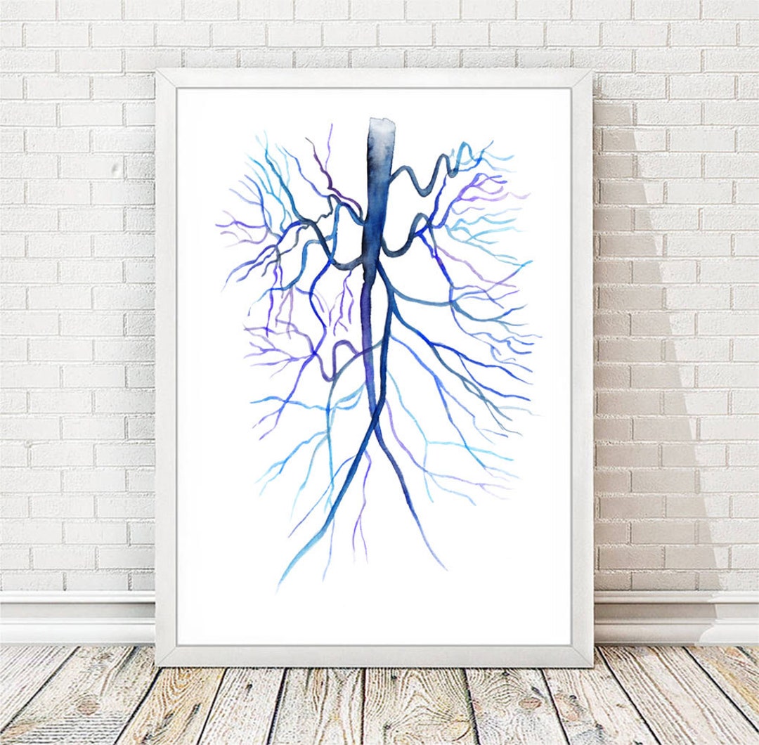 Aorta Angiogram Print, Medical Poster, Science Art, Abdominal ...