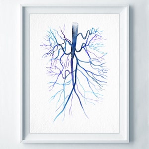 Aorta Angiogram Print, Medical Poster, Science Art, Abdominal ...