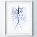 Aorta Angiogram Print, Medical Poster, Science Art, Abdominal ...