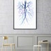 Aorta Angiogram Print, Medical Poster, Science Art, Abdominal ...