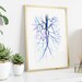 Aorta Angiogram Print, Medical Poster, Science Art, Abdominal ...