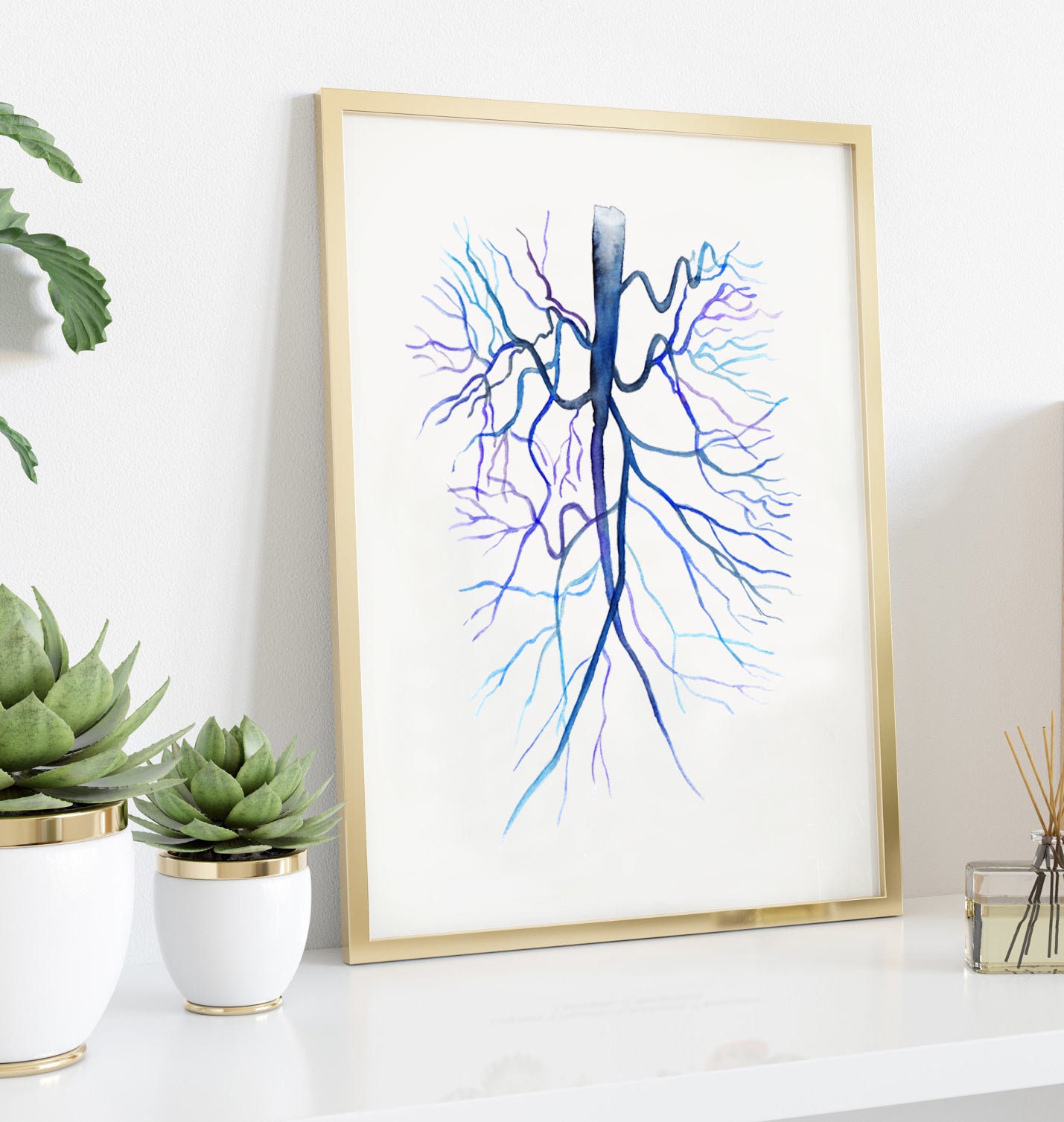 Aorta Angiogram Print, Medical Poster, Science Art, Abdominal ...