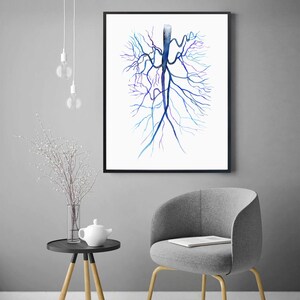 Aorta Angiogram Print, Medical Poster, Science Art, Abdominal ...