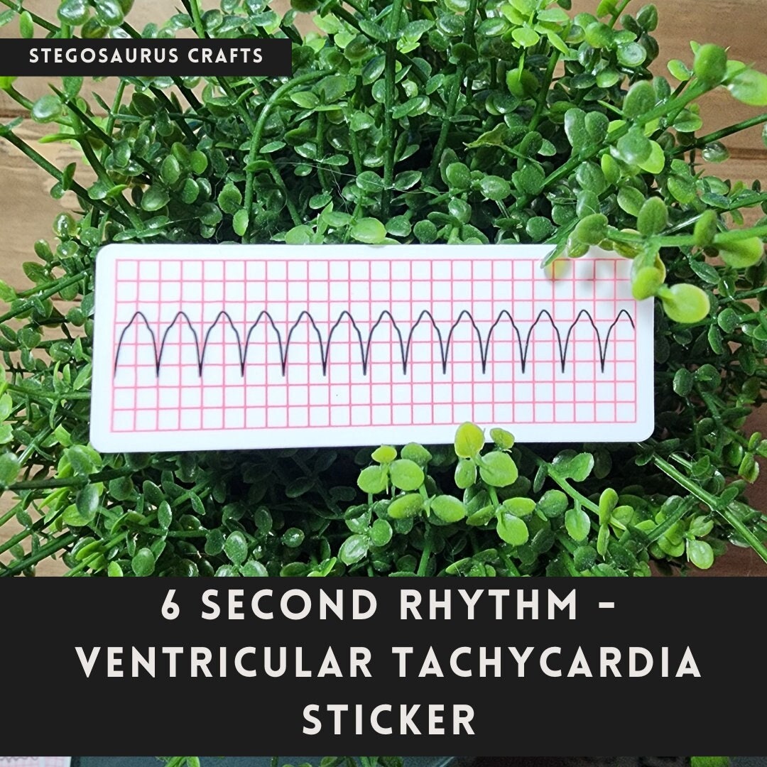 Ventricular Tachycardia EKG Strip accurate Nursing/medical Sticker - Etsy