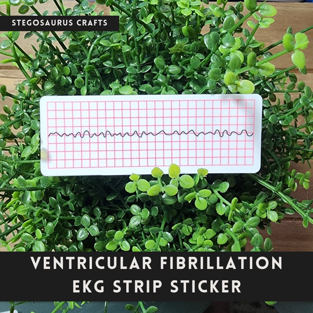 Ventricular Fibrillation EKG Strip accurate Nursing/medical Sticker - Etsy