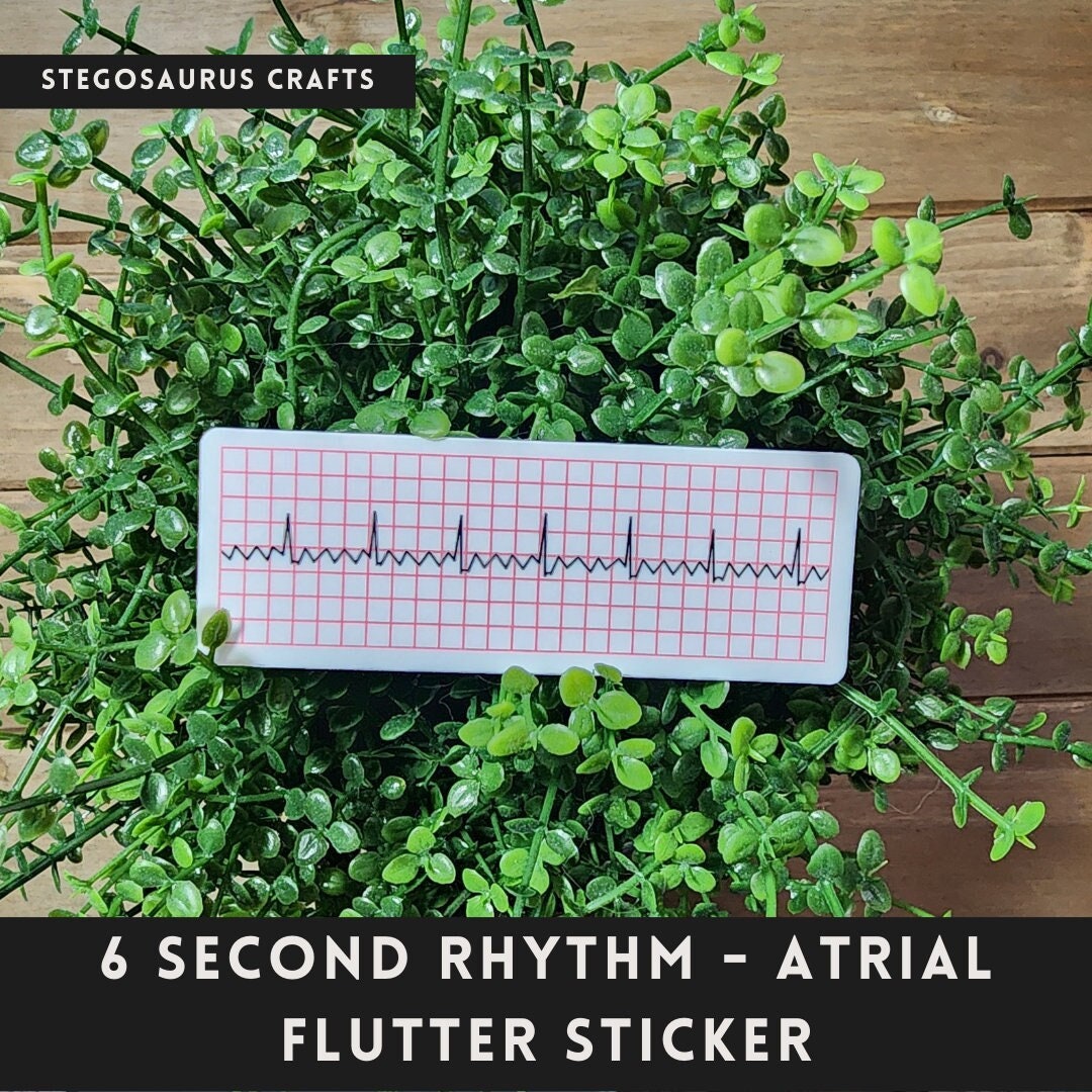 Atrial Flutter 6 Second Rhythm Strip (accurate) - Nursing/medical ...