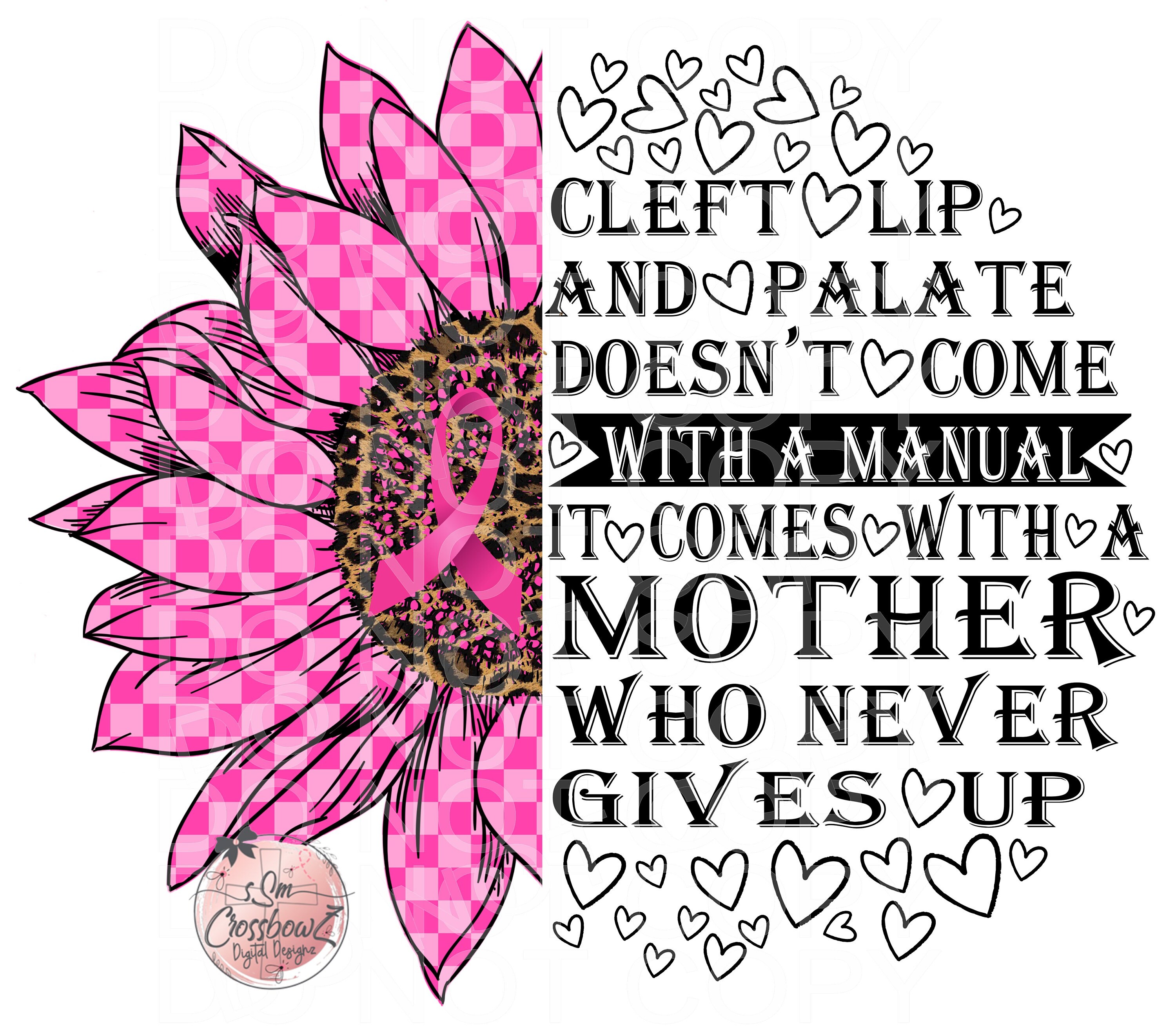 Cleft Palate Quotes
